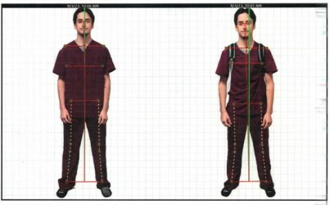 What are the Effects of Heavy Backpacks?